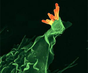 `TB claims 68,000 lives annually` - Newspaper - DAWN.COM