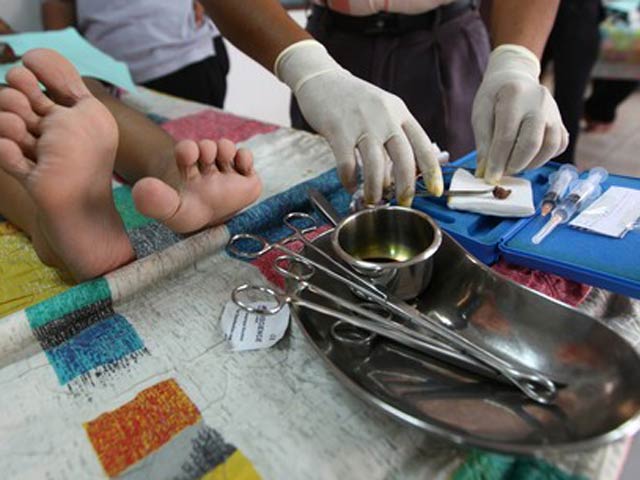 Underweight people at higher post-surgery risk - DAWN.COM