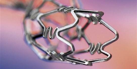 FDA sees rare but serious issue with stents - DAWN.COM
