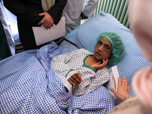 Afghan child bride tells of 'torture' by in-laws - World - DAWN.COM