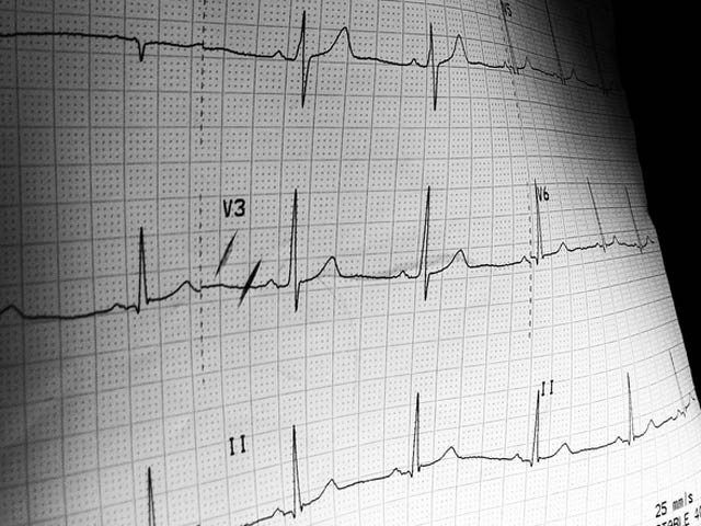 Injection saves lives for heart attack patients - DAWN.COM