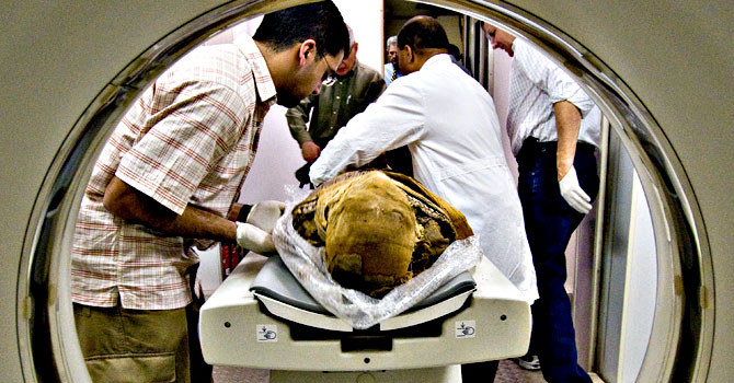 Ancient people also had clogged arteries, mummy scans show - DAWN.COM