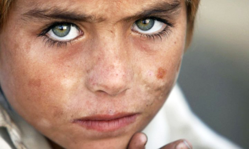 Children of war - DAWN.COM