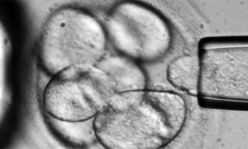 Britain allows first genetic modification of embryos - World - DAWN.COM