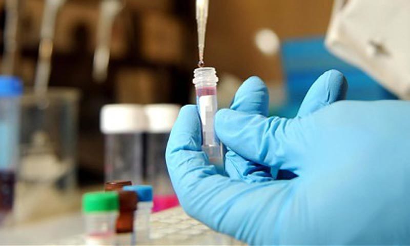 CM opens drug-testing laboratory - Pakistan - DAWN.COM