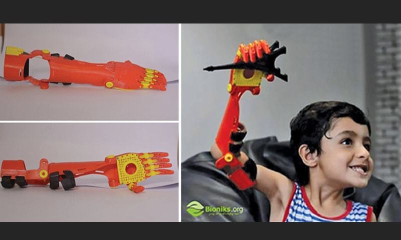 Creating bionic superheroes - Trends - Aurora