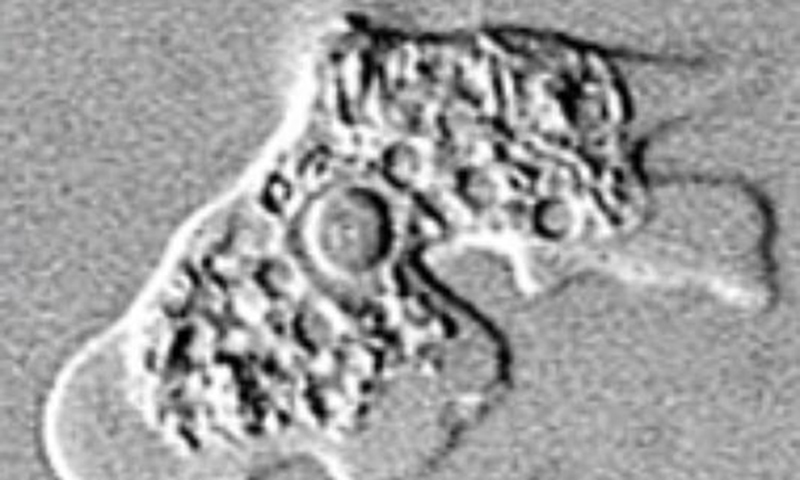 Karachi reports first death due to ‘brain-eating’ amoeba - Pakistan ...