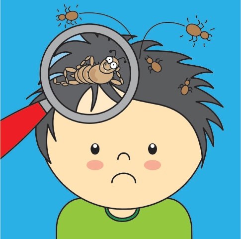 Back-to-school advice: All about lice - Newspaper - DAWN.COM