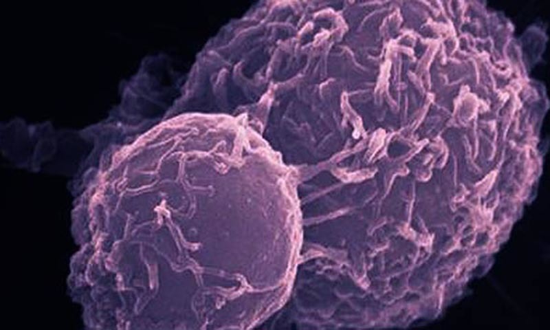 LUMHS sets up Pakistan’s first cancer research laboratory - Pakistan ...