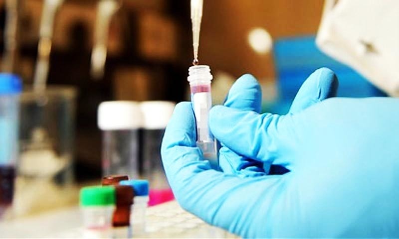 NAB forensic lab awaits interior ministry’s NOC - Pakistan - DAWN.COM