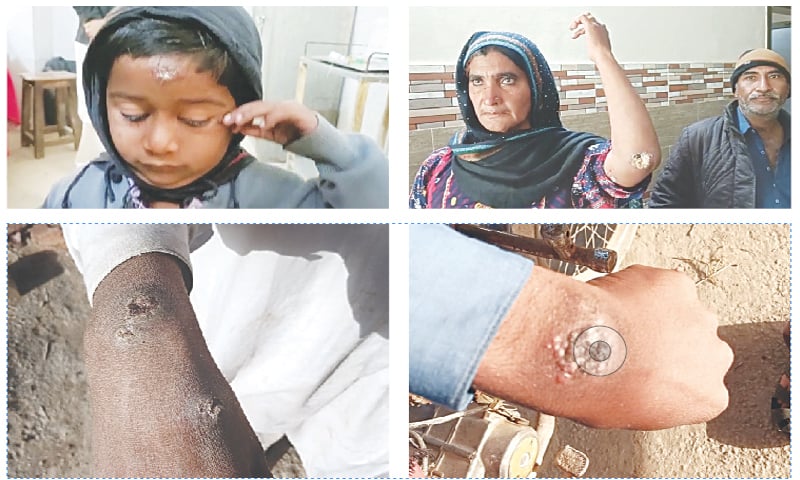 Several thousand affected by vector-borne skin disease across Kachho ...